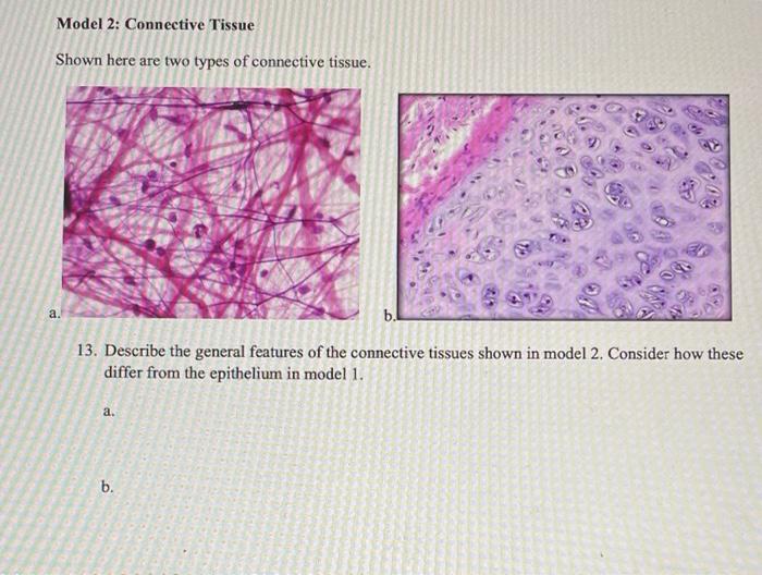 Solved Model 2: Connective Tissue Shown here are two types | Chegg.com