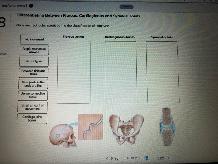 Solved ning Assignment 8 Differentiating Between Fibrous, | Chegg.com