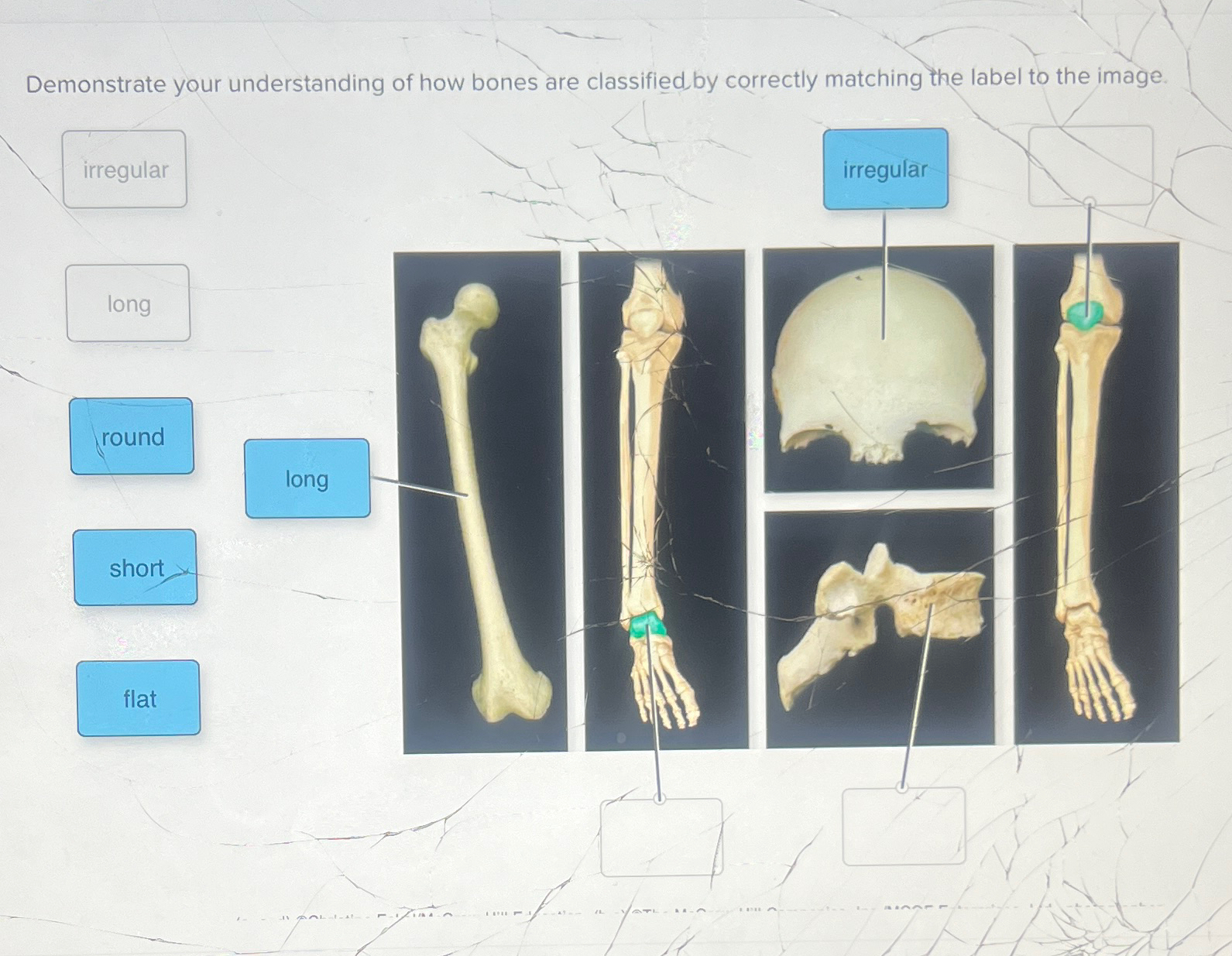 Solved Demonstrate your understanding of how bones are | Chegg.com