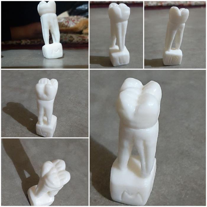 Carving a mandibular first molar tooth on the soap | Chegg.com