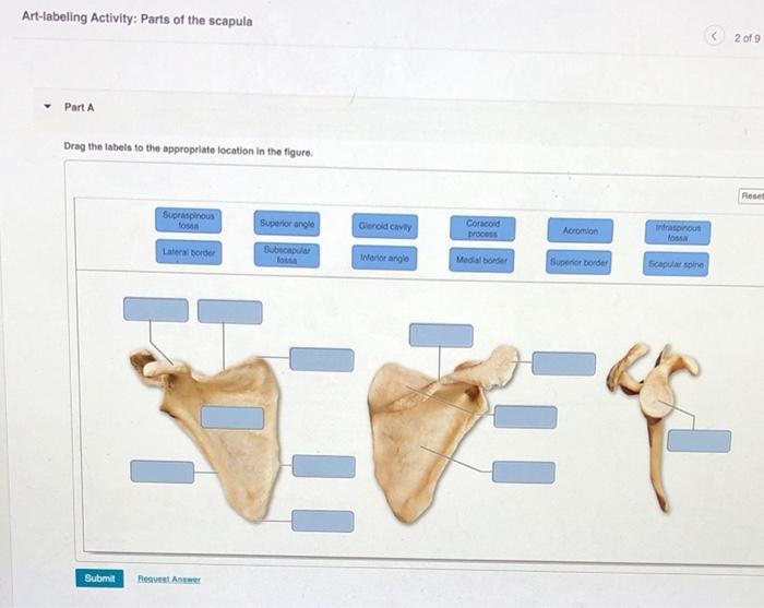Solved Art-labeling Activity: Parts of the scapula 2 of 9 | Chegg.com