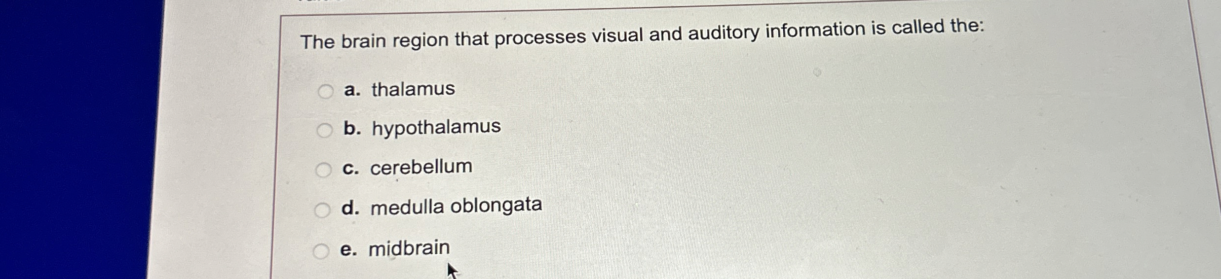Solved The brain region that processes visual and auditory | Chegg.com