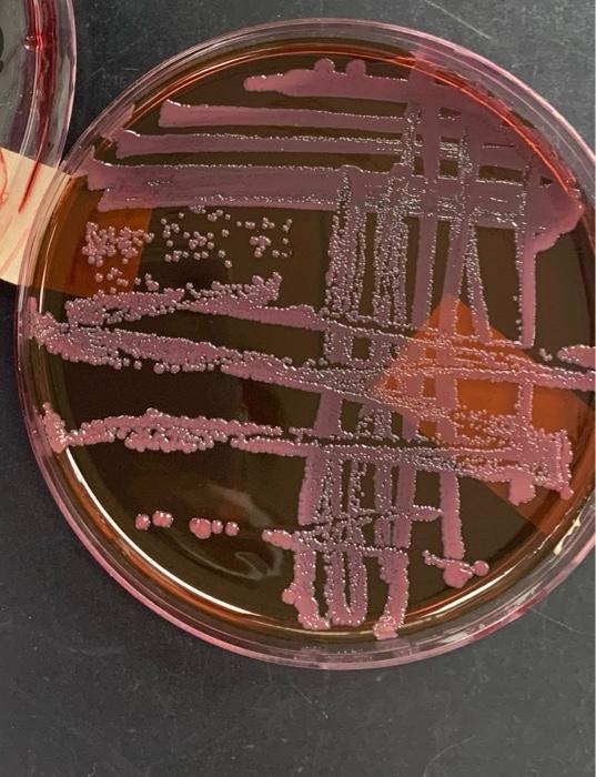 Solved Nake obsenvations of the colonies observed on the EMB | Chegg.com