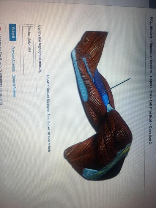 Solved Course Home Muscular System - Upper Limb > Lab | Chegg.com