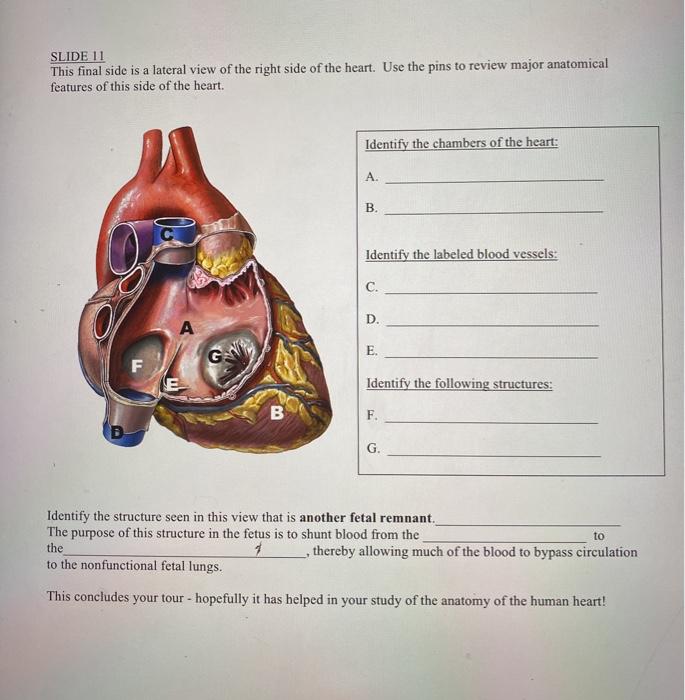 Solved SLIDE 11 This final side is a lateral view of the | Chegg.com