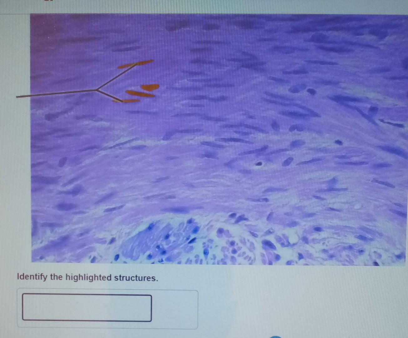 Solved Identify the highlighted structures. | Chegg.com