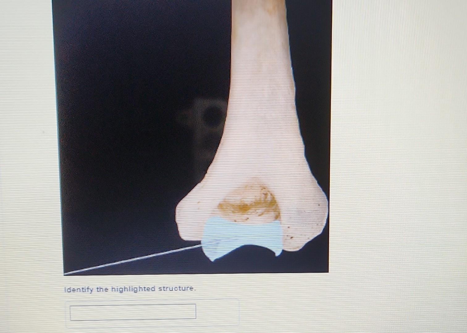 Solved Identify the highlighted structure. Identify the | Chegg.com