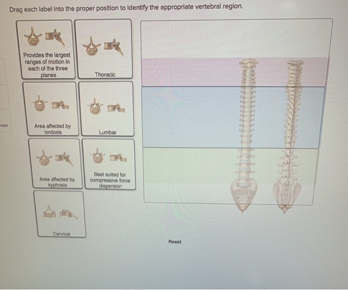 Solved Drag each label into the proper position to identify | Chegg.com