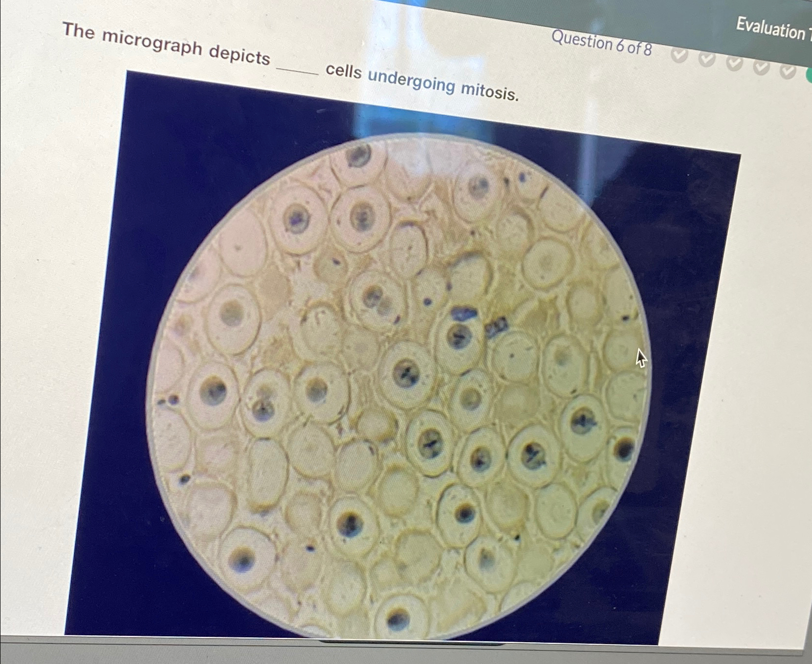 Solved The micrograph depicts q, ﻿cells undergoing mitosis. | Chegg.com