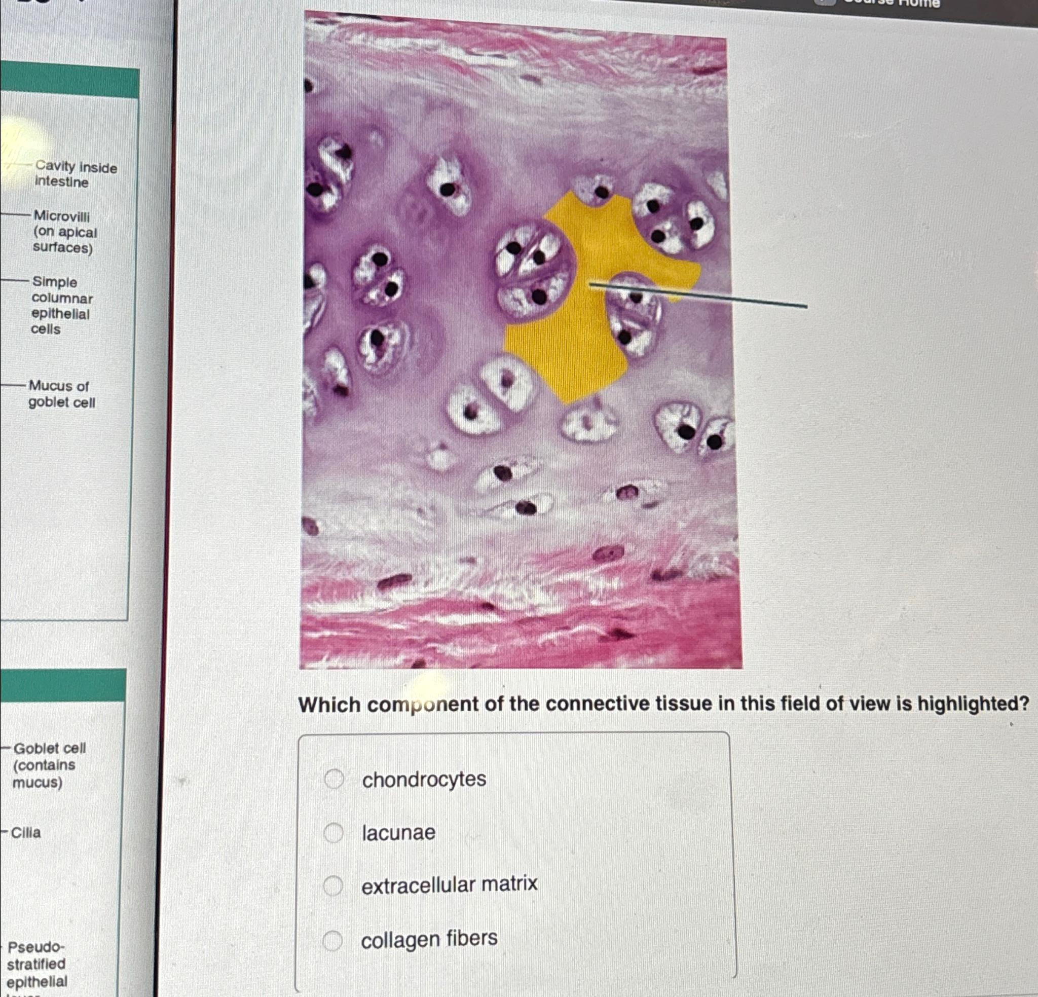 Solved Which component of the connective tissue in this | Chegg.com