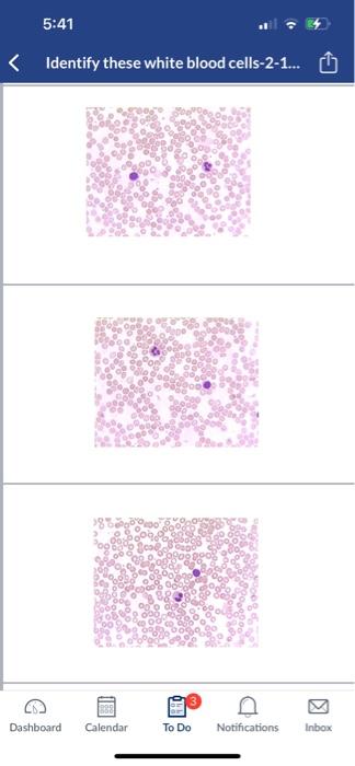 Solved 5:41 Identify these white blood cells-2-1... (1) | Chegg.com