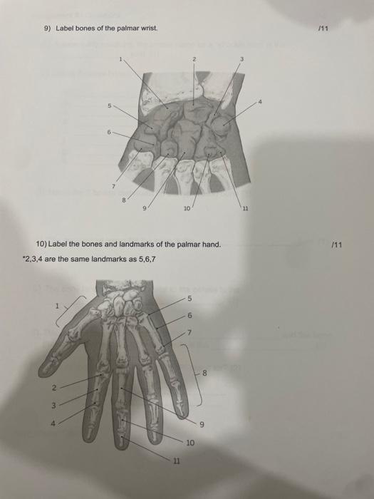Solved 9) Label bones of the palmar wrist. 10) Label the | Chegg.com