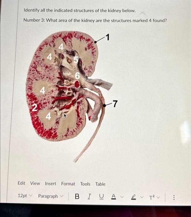 Solved Identify all the indicated structures of the kidney | Chegg.com