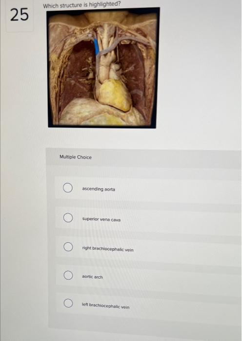Solved Which structure is highlighted? Multiple Choice | Chegg.com