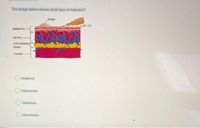 Solved The image below shows what type of injection? wheal | Chegg.com