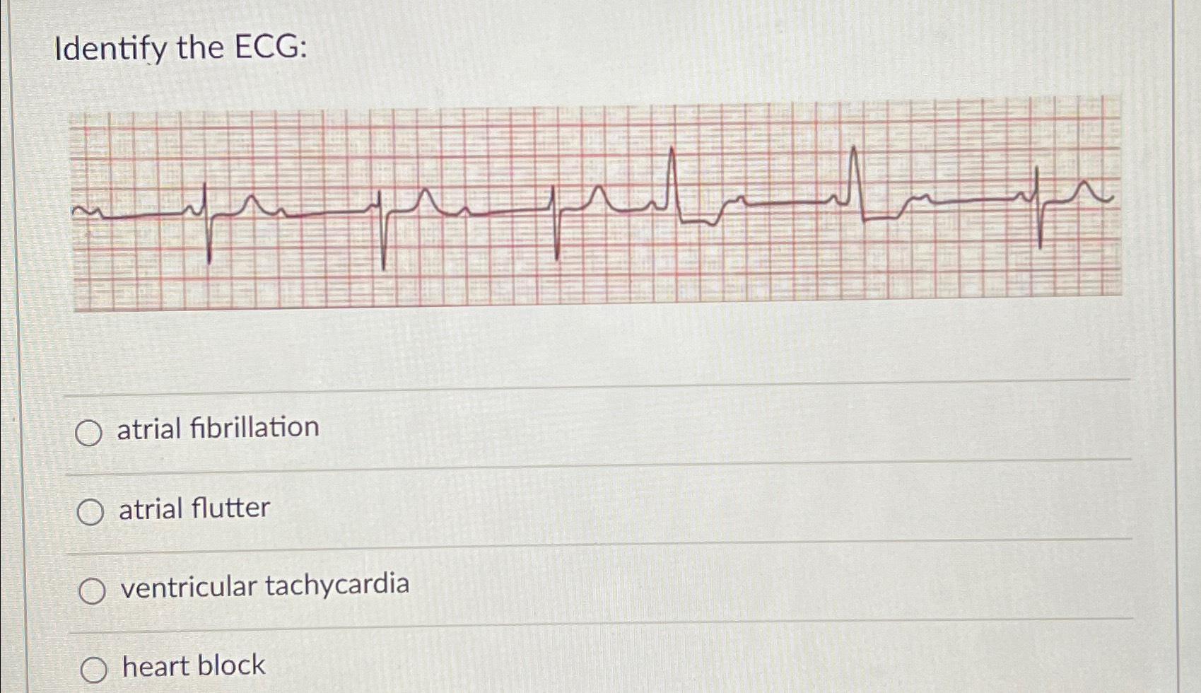 Solved Identify the ECG:atrial fibrillationatrial | Chegg.com