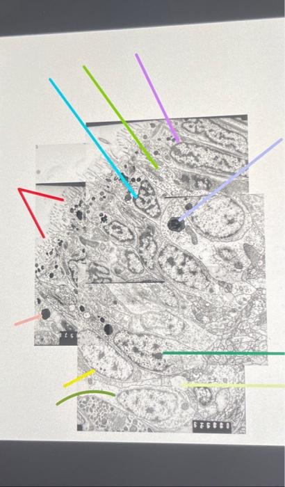 label the TEM image below as many as you can label | Chegg.com