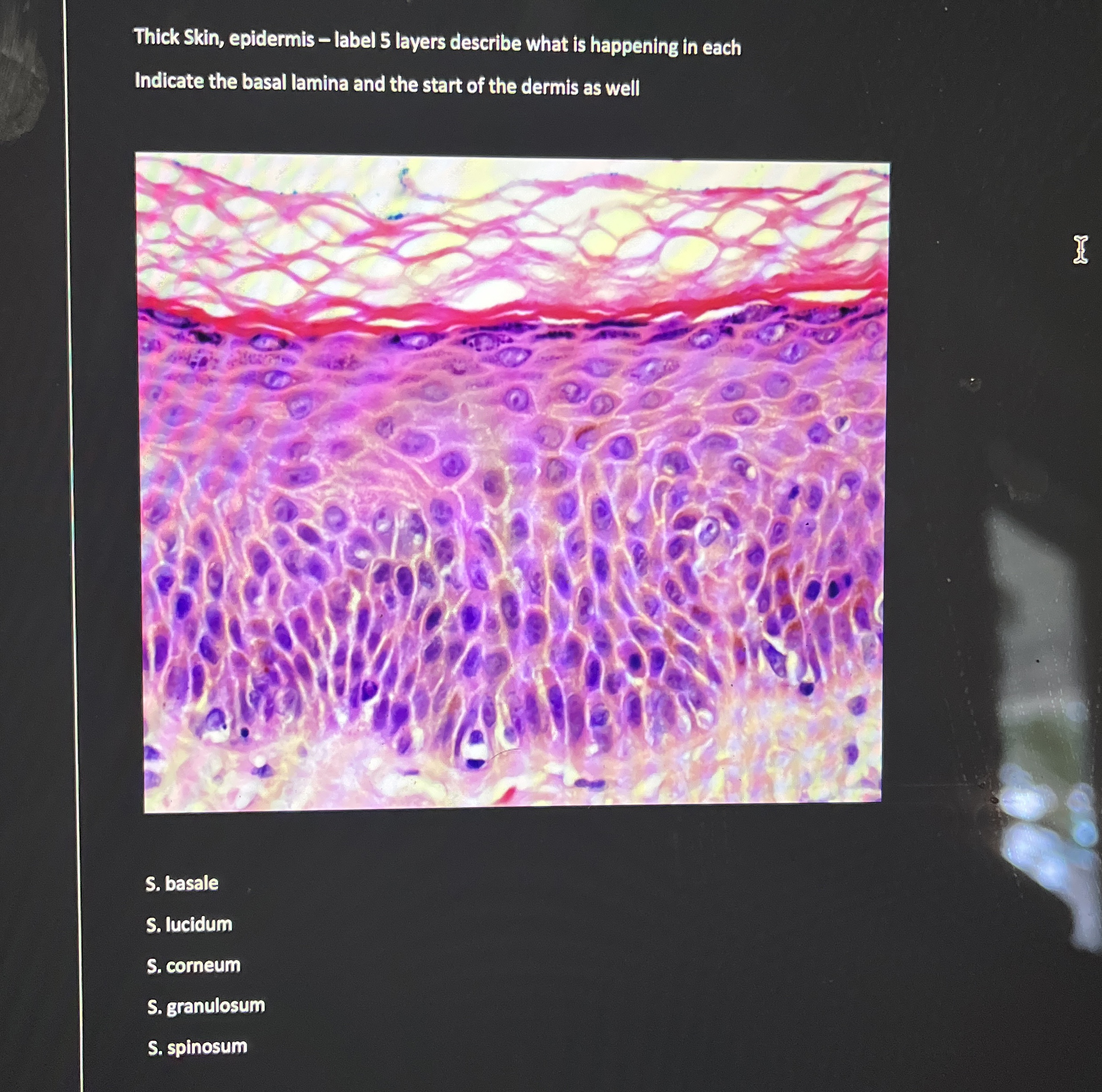 Solved Thick Skin, epidermis - ﻿label 5 ﻿layers describe | Chegg.com