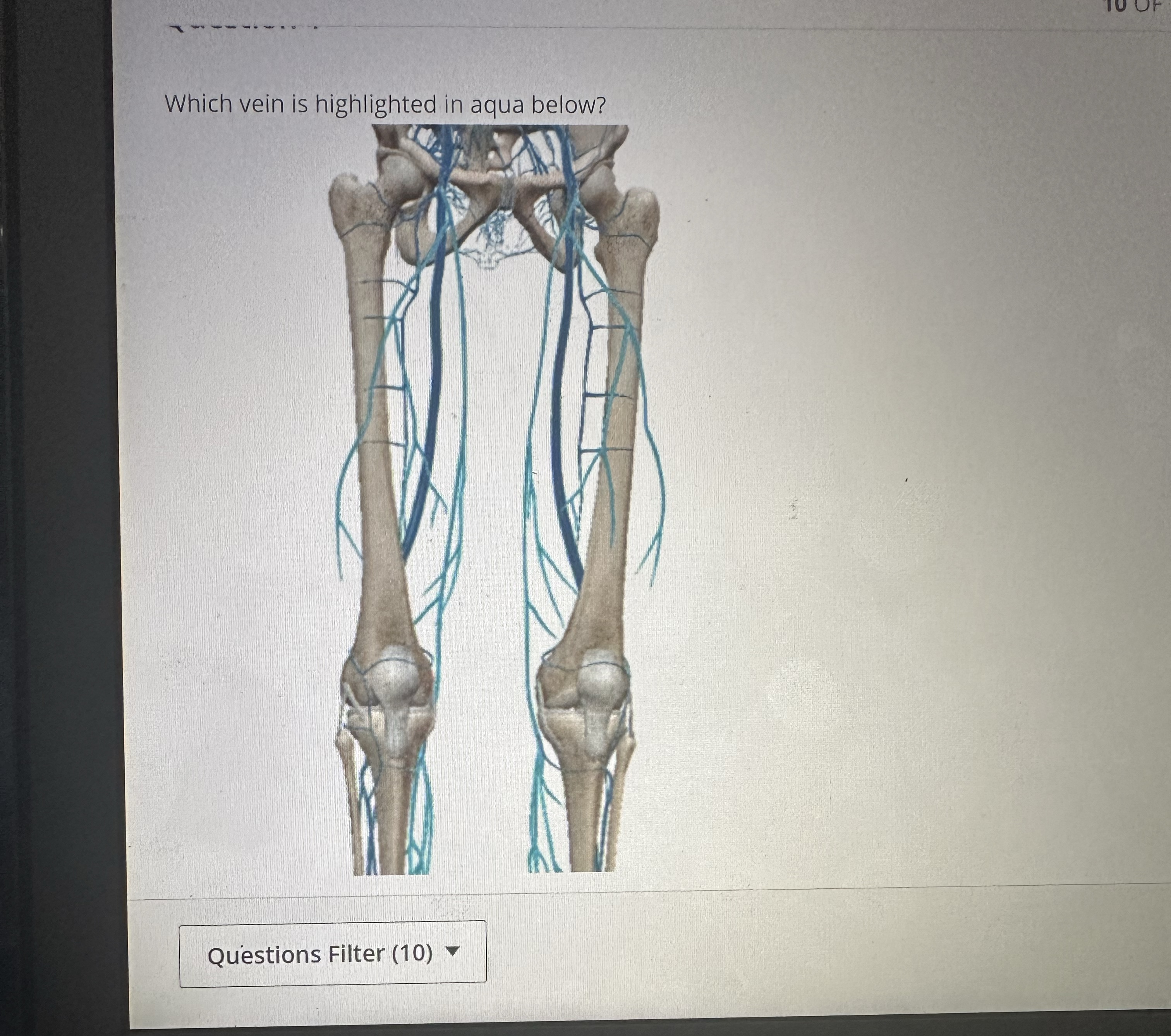 Solved Which vein is highlighted in aqua below?Questions | Chegg.com