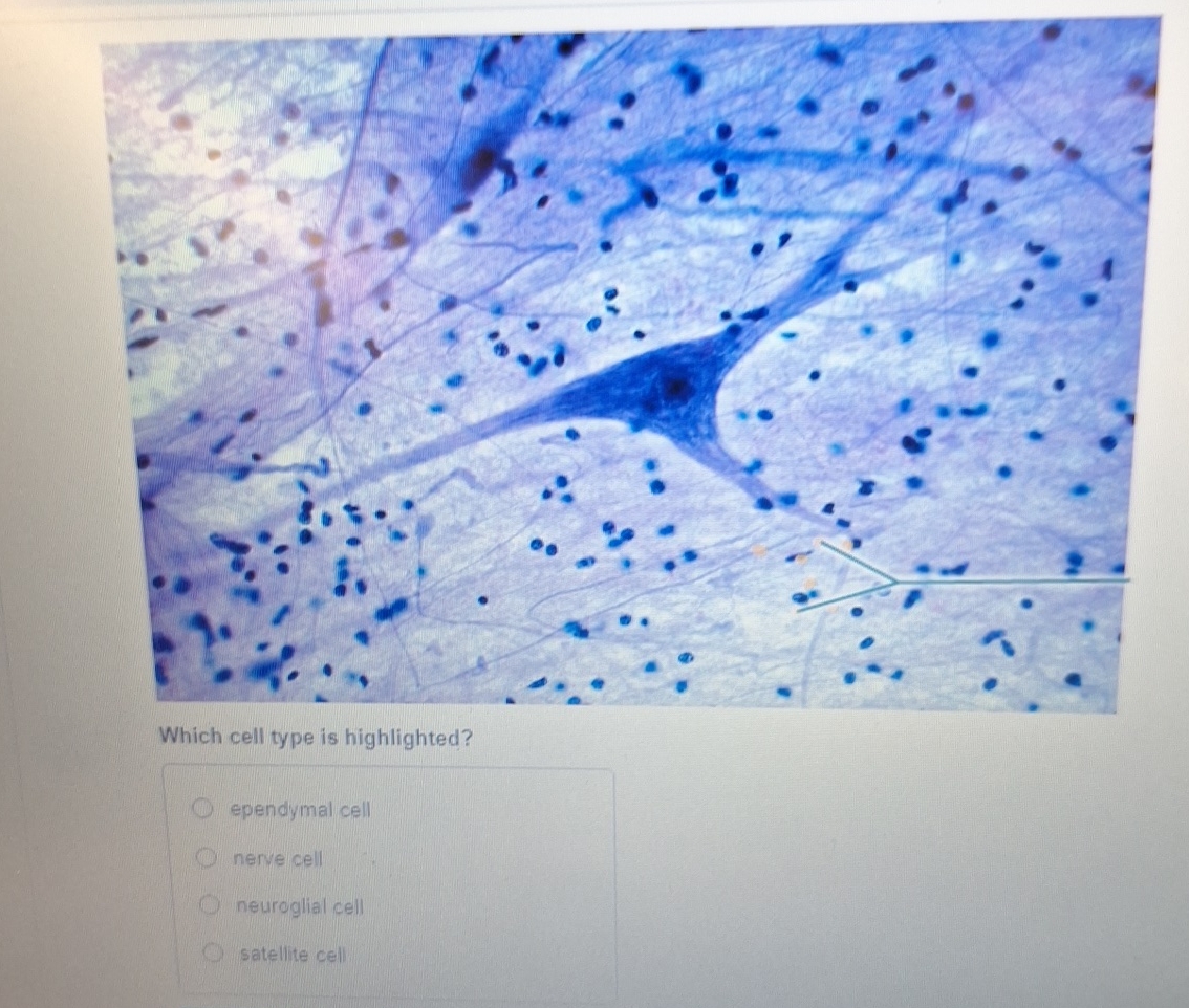 Solved Which cell type is highlighted?0ependymal cellOnerve | Chegg.com