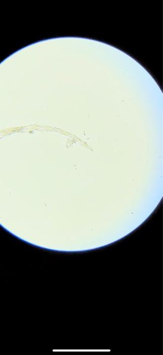 Is This A Gram Positive Or Negitive