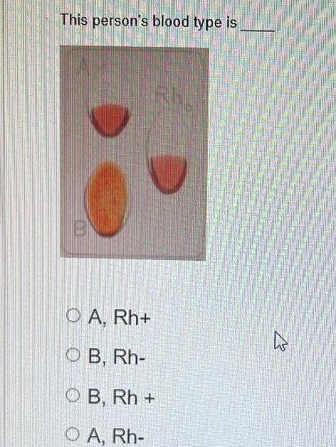 Solved This person's blood type is RH OA, Rh+ OB, Rh- OB, | Chegg.com
