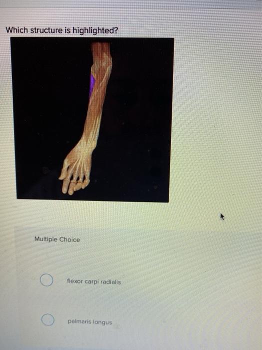 Solved Which structure is highlighted? Multiple Choice | Chegg.com