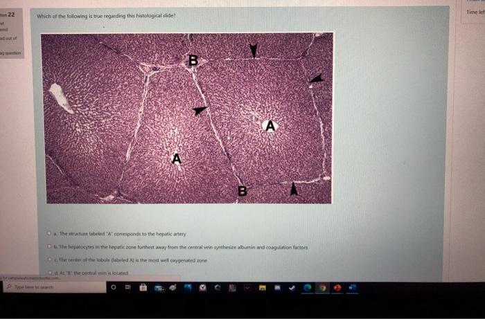 Solved Tiene et 22 Which of the following is true regarding | Chegg.com