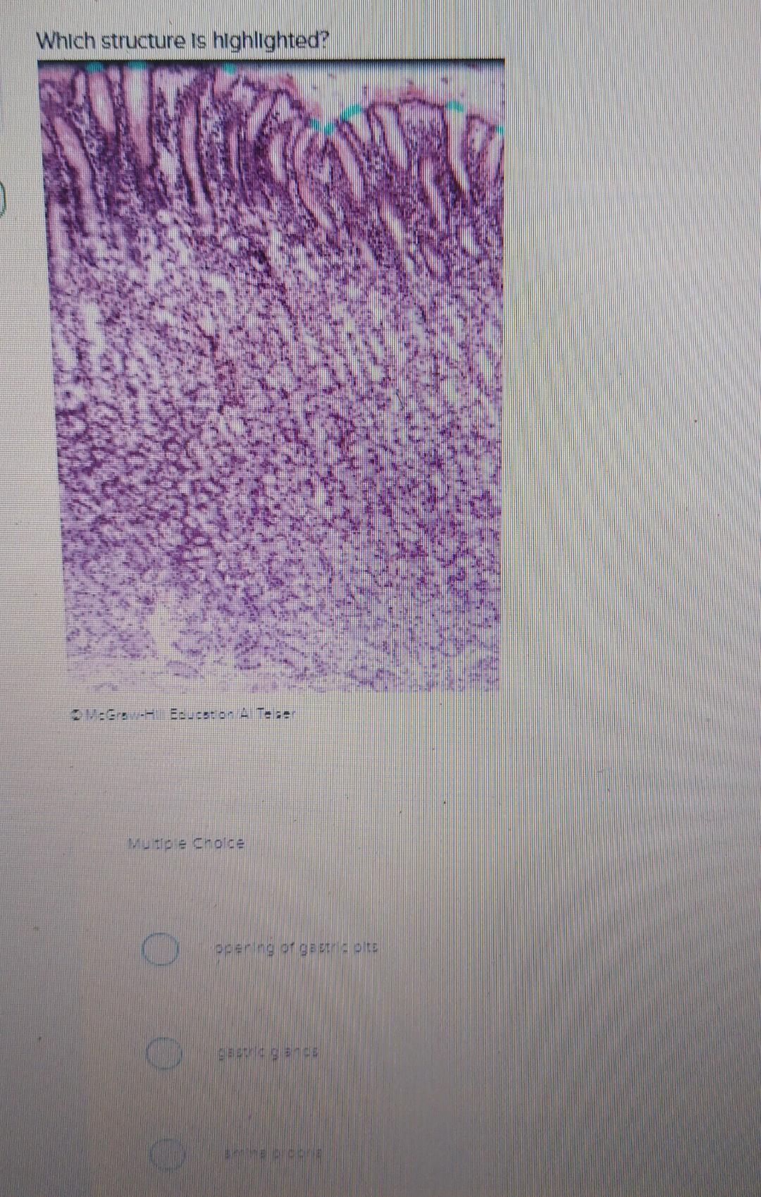 Solved Which structure is highlighted? Mutiple Cholce cecum | Chegg.com