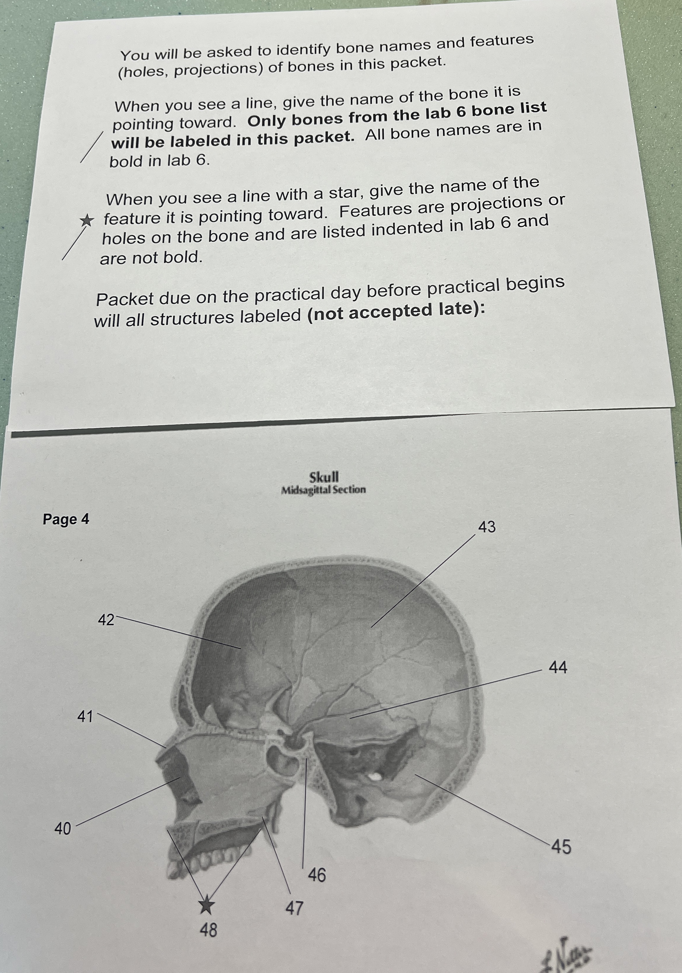Solved You will be asked to identify bone names and features | Chegg.com