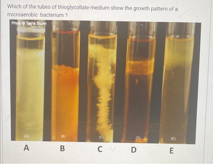 Which of the tubes of thioglycollate medium show the | Chegg.com
