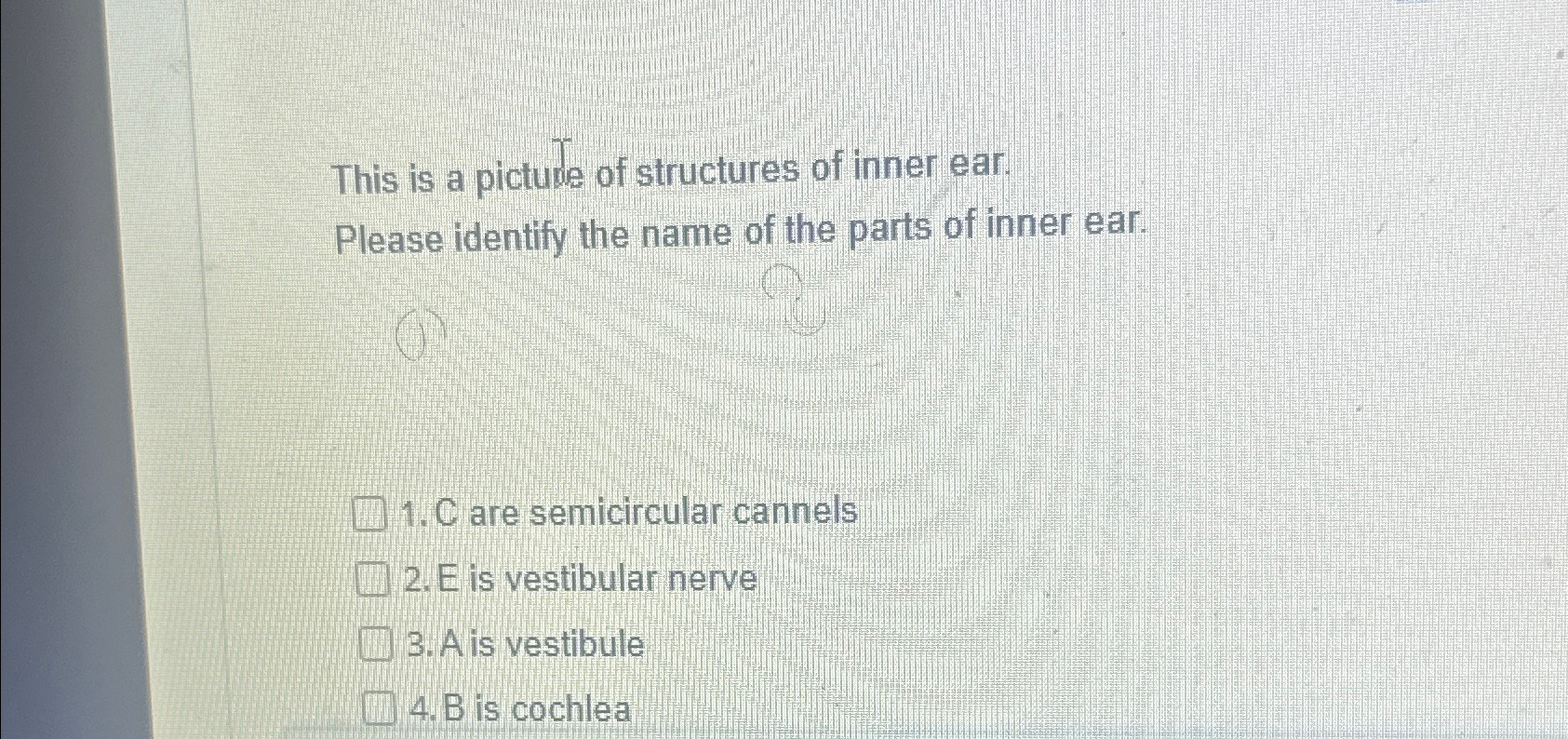 Solved This is a pictude of structures of inner ear. Please | Chegg.com