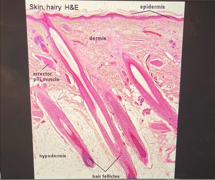 Solved question 1 - the hypodermis lies below the dermis and | Chegg.com