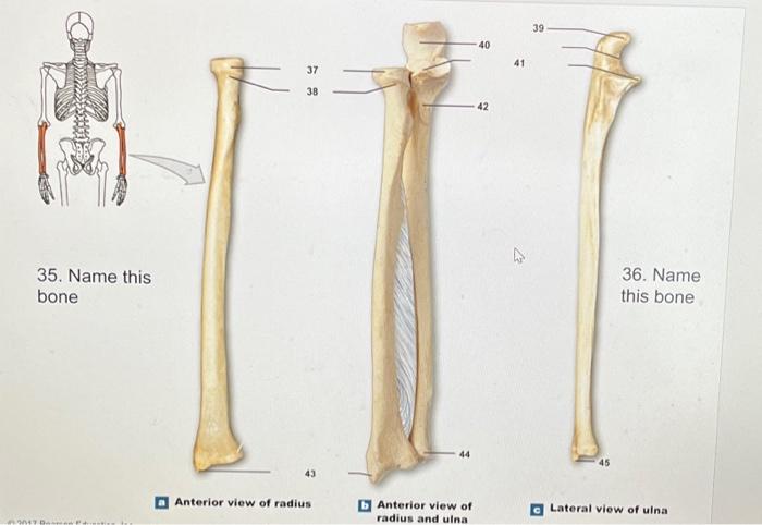 Solved 39 41 Anterior view of radius D Anterior view of | Chegg.com