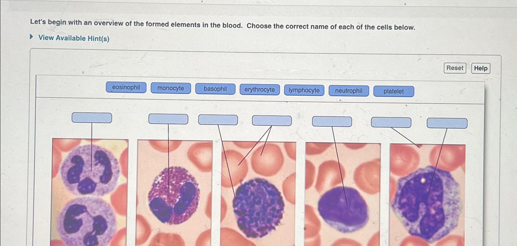 Solved Let's begin with an overview of the formed elements | Chegg.com