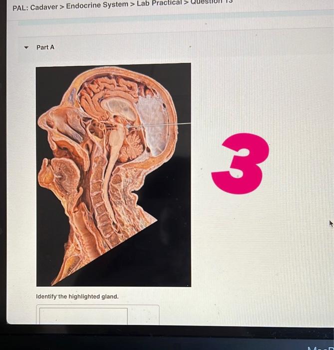 Solved Identify the highlighted structure.PAL: Cadaver > | Chegg.com