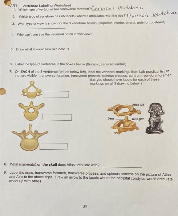 Solved PART I: Vertebrae Labeling Worksheet 1. Which type of | Chegg.com
