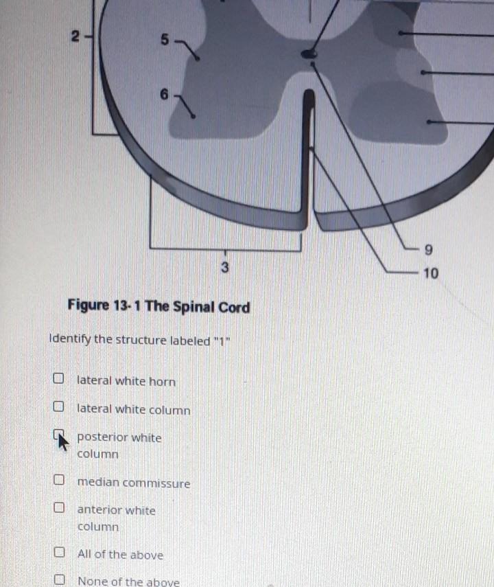 2 5 9 3 10 Figure 13- 1 The Spinal Cord Identify the | Chegg.com