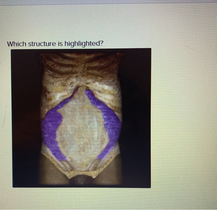 Solved Which structure is highlighted? О anterior rectus | Chegg.com