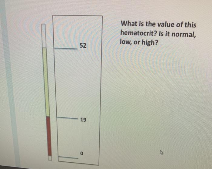 Solved What is the value of this hematocrit? Is it normal, | Chegg.com