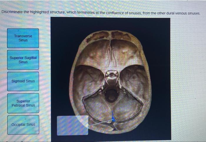 Solved Discriminate the highlighted structure, which | Chegg.com