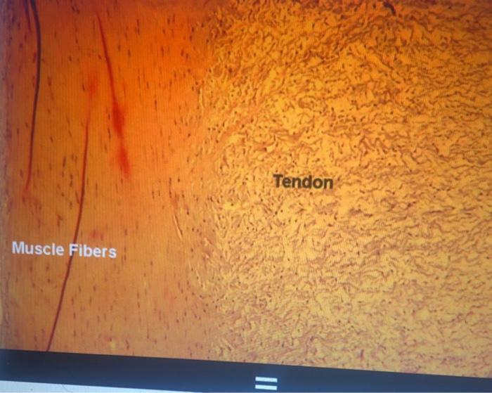 Solved Tendon Muscle Fibers Nuclei Collagen Fibers II | Chegg.com