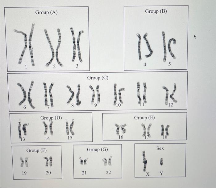 Solved On the next page is a banded chromosome spread from a | Chegg.com