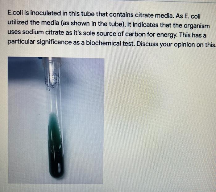 Solved E.coli is inoculated in this tube that contains | Chegg.com