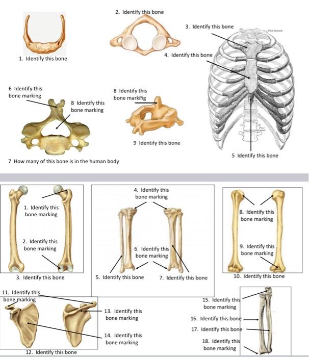 Solved 2. Identify this bone 3. Identify this bone 1. | Chegg.com