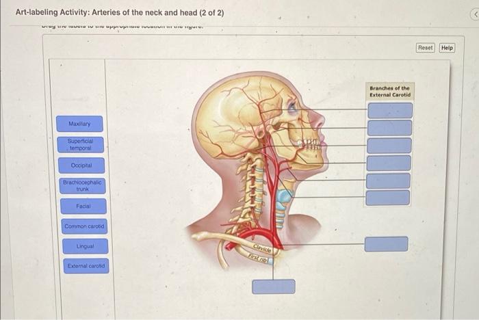 Solved Art-labeling Activity: Arteries of the neck and head | Chegg.com