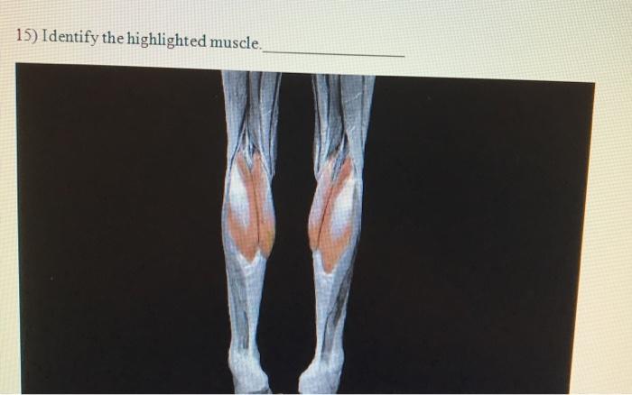 Solved 16) Identify the highlighted muscle. 15) Identify | Chegg.com