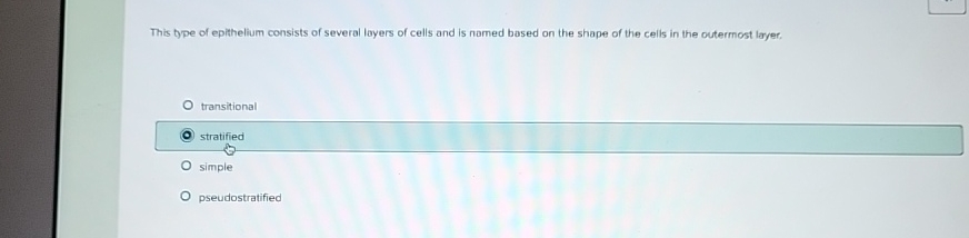 Solved This type of epithelium consists of several layers of | Chegg.com