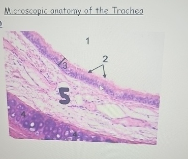Solved Microscopic anatomy of the Trachea1/3 | Chegg.com