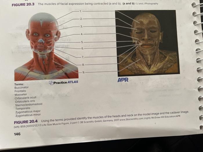 Solved FIGURE 20.3 The muscles of facial expression being | Chegg.com